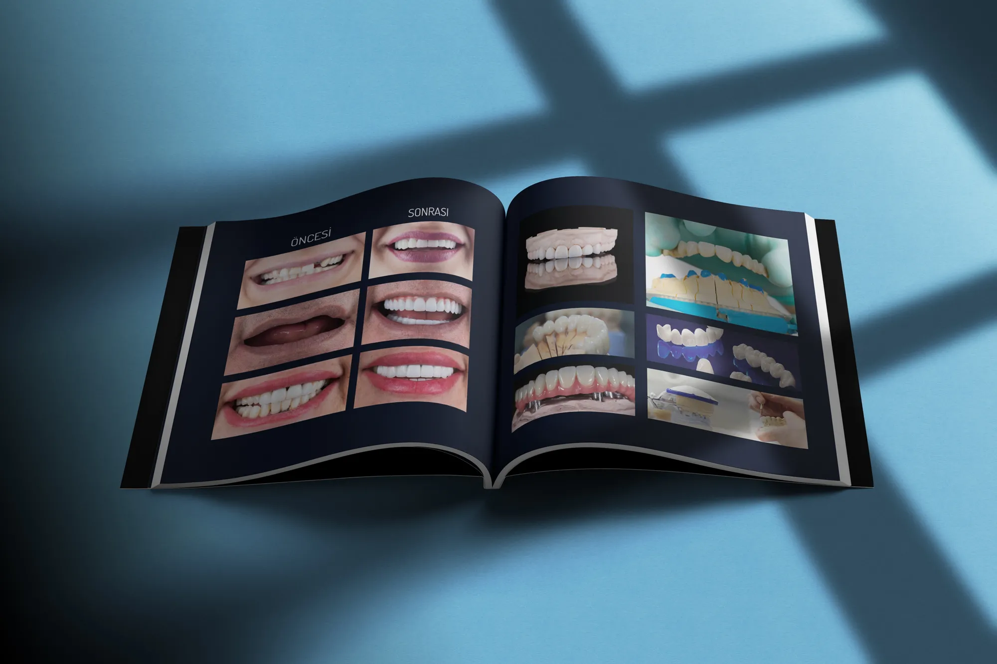 Dental Laboratory Catalog Design - Dental Agency